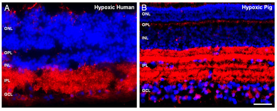 Differential Distribution of RBPMS in Pig, Rat, and Human Retina after ...