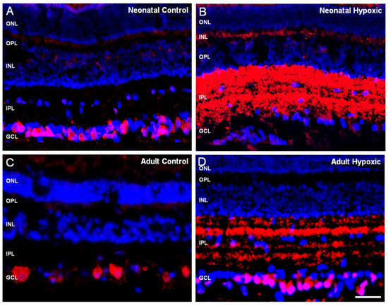 Differential Distribution of RBPMS in Pig, Rat, and Human Retina after ...