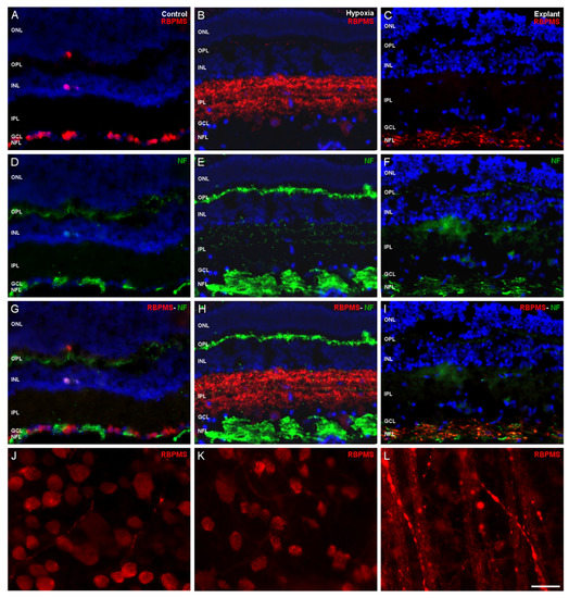 Differential Distribution of RBPMS in Pig, Rat, and Human Retina after ...