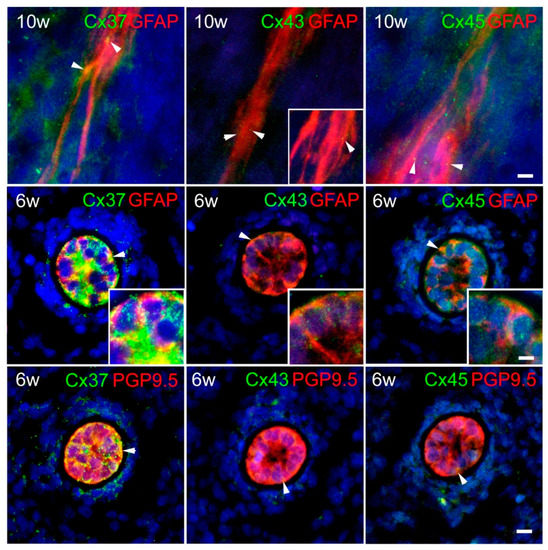 IJMS | Free Full-Text | Expression of Connexins 37, 43 and 45 in ...