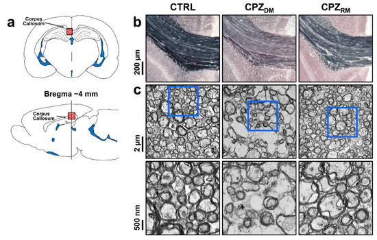 Temporal Changes in In Vivo Glutamate Signal during Demyelination and ...
