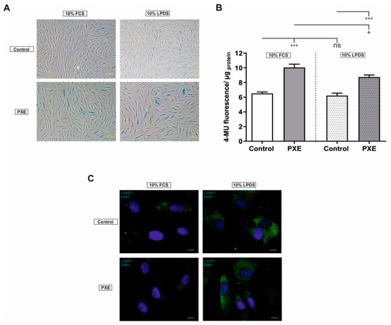 Linking ABCC6 Deficiency in Primary Human Dermal Fibroblasts of PXE ...