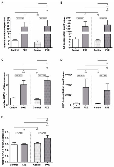 Linking ABCC6 Deficiency in Primary Human Dermal Fibroblasts of PXE ...