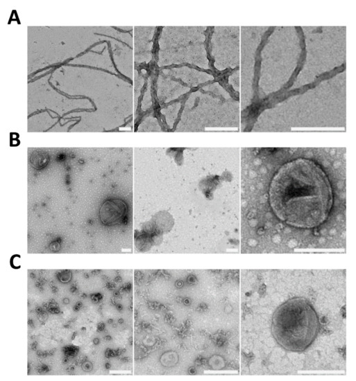 Extracellular Vesicles-Encapsulated Yeast Prions and What They Can Tell ...
