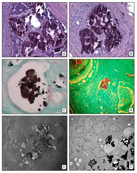 IJMS | Free Full-Text | Molecular Aspects and Prognostic Significance ...