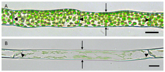 3D Dissection of Structural Membrane-Wall Contacts in Filamentous Moss ...