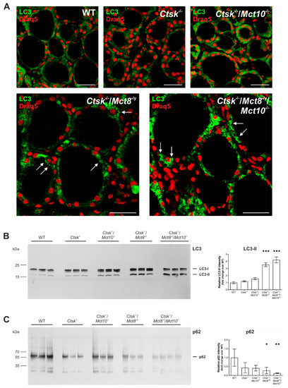 The Thyroid Hormone Transporter Mct8 Restricts Cathepsin-Mediated ...