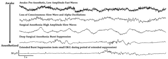 Molecular Diversity of Anesthetic Actions Is Evident in ...