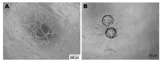 Endothelial Cells as Tools to Model Tissue Microenvironment in Hypoxia ...