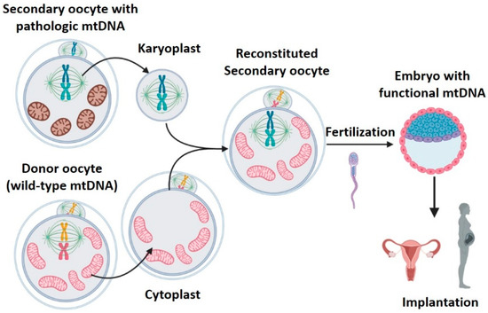 Mitochondrial DNA Replacement Techniques to Prevent Human Mitochondrial ...
