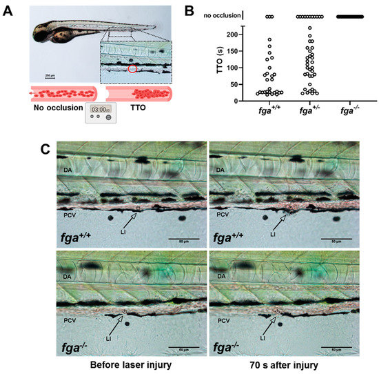 IJMS | Free Full-Text | Venous Thrombosis and Thrombocyte Activity in ...