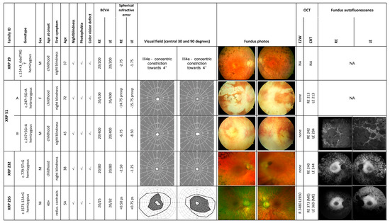 X-Linked Retinitis Pigmentosa Caused by Non-Canonical Splice Site ...