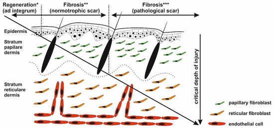 Molecular Changes Underlying Hypertrophic Scarring Following Burns ...