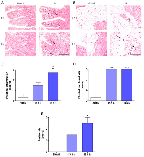 Pro-Inflammatory Effects of Indoxyl Sulfate in Mice: Impairment of ...