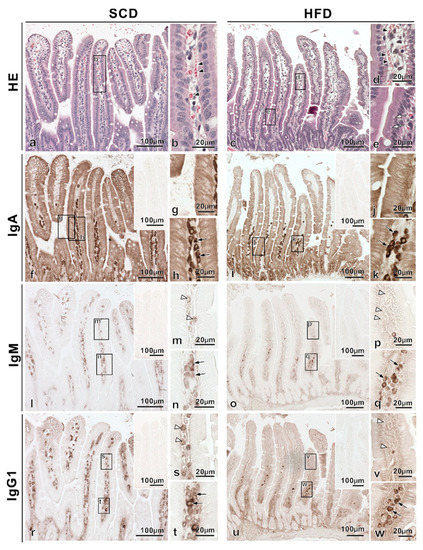 High-Fat Diet and Age-Dependent Effects of IgA-Bearing Cell Populations ...