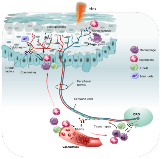 Immune Actions on the Peripheral Nervous System in Pain
