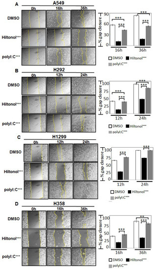 Hiltonol Cocktail Kills Lung Cancer Cells by Activating Cancer ...