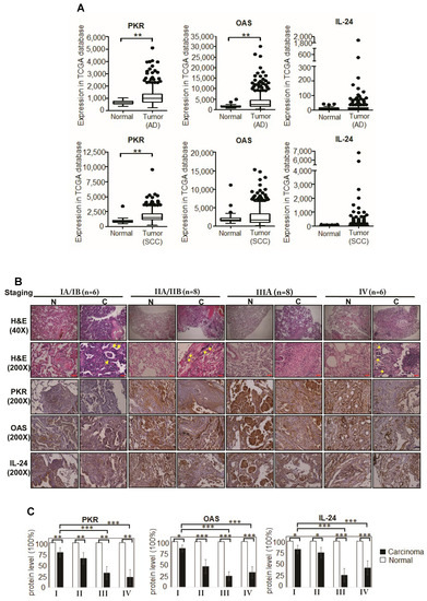 Hiltonol Cocktail Kills Lung Cancer Cells by Activating Cancer ...