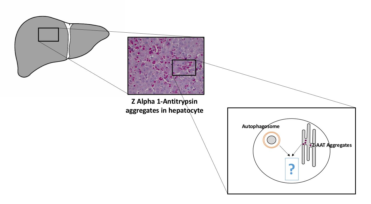 IJMS | Free Full-Text | The Autophagy Pathway: A Critical Route in the ...