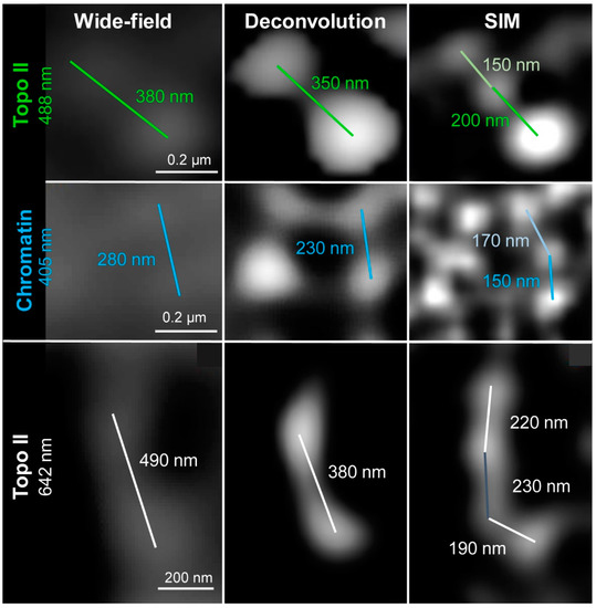 Comparing Super-Resolution Microscopy Techniques to Analyze Chromosomes