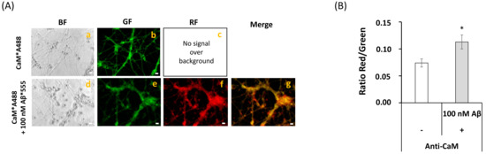 IJMS | Free Full-Text | Binding of Amyloid β(1–42)-Calmodulin Complexes to Plasma Membrane Lipid ...