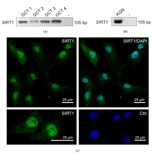Sirtuin 1 and Sirtuin 3 in Granulosa Cell Tumors