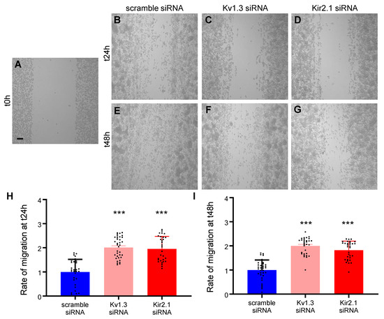 Potassium Channels Kv1.3 and Kir2.1 But Not Kv1.5 Contribute to BV2 ...