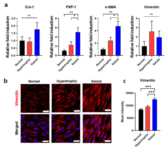 Ameliorating Fibrotic Phenotypes of Keloid Dermal Fibroblasts through ...