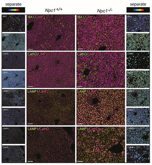 GCase and LIMP2 Abnormalities in the Liver of Niemann Pick Type C Mice