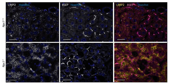 GCase and LIMP2 Abnormalities in the Liver of Niemann Pick Type C Mice