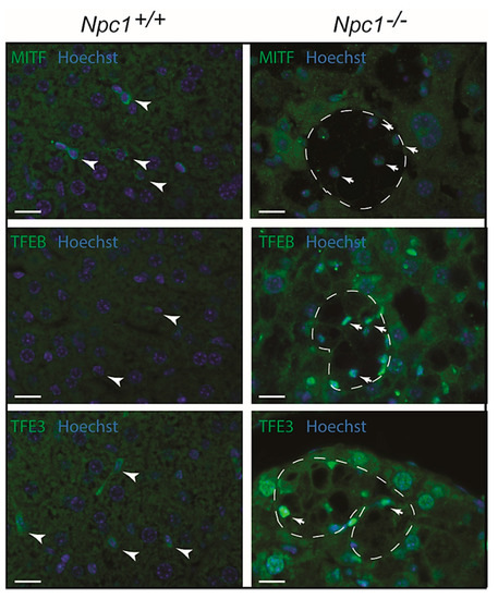GCase and LIMP2 Abnormalities in the Liver of Niemann Pick Type C Mice