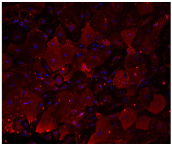The History and Mystery of Alveolar Epithelial Type II Cells: Focus on ...