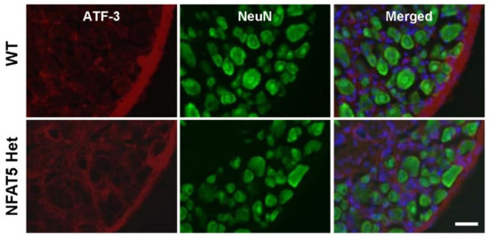 NFAT5 Deficiency Alleviates Formalin-Induced Inflammatory Pain Through mTOR