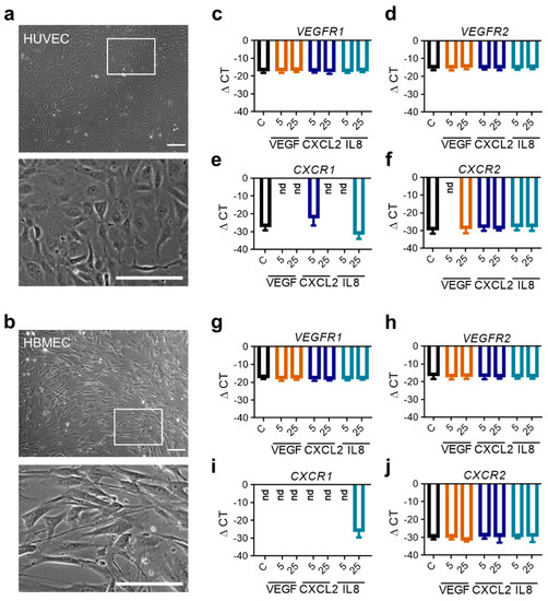 The CXCL2/IL8/CXCR2 Pathway Is Relevant for Brain Tumor Malignancy and ...