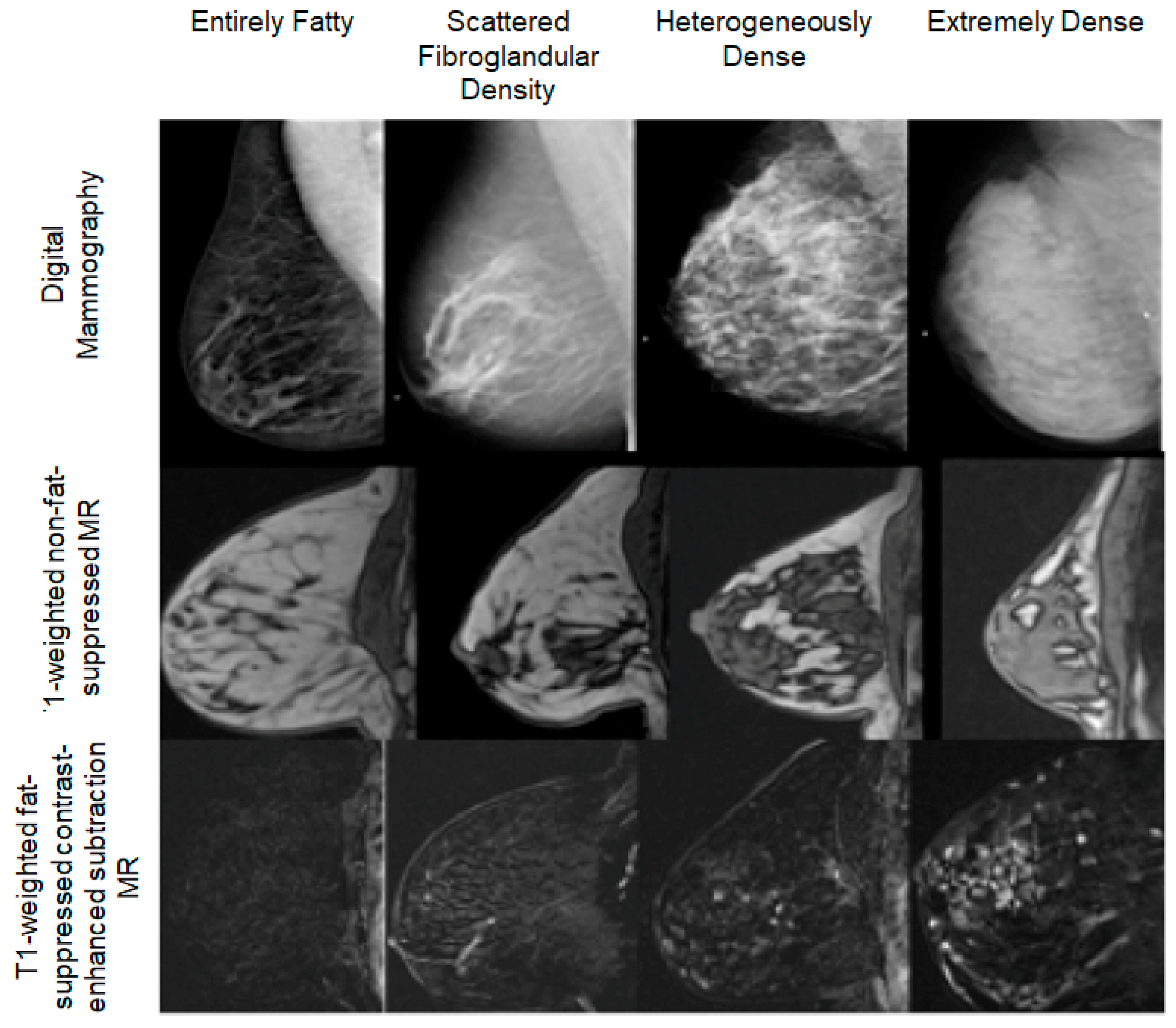 Ijms Free Full Text Diabetes Obesity And Inflammation Impact On