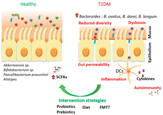 Dysbiosis in the Development of Type I Diabetes and Associated ...