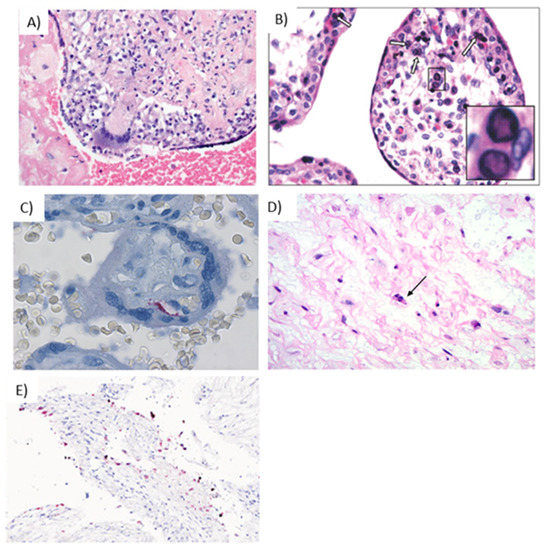 Placental Immune Responses to Viruses: Molecular and Histo-Pathologic ...