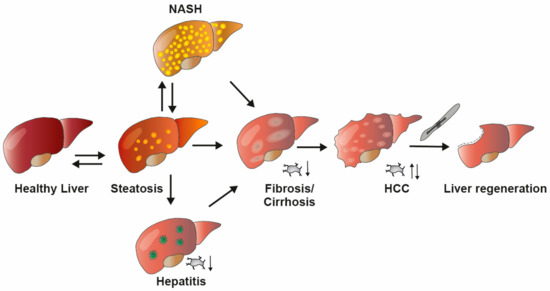 Till Death Do Us Part—The Multifaceted Role of Platelets in Liver Diseases