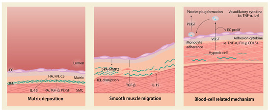 IJMS | Special Issue : Molecular Basis of Vascular Remodeling