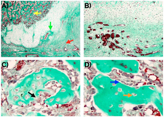 Expression of Musashi-1 Increases in Bone Healing