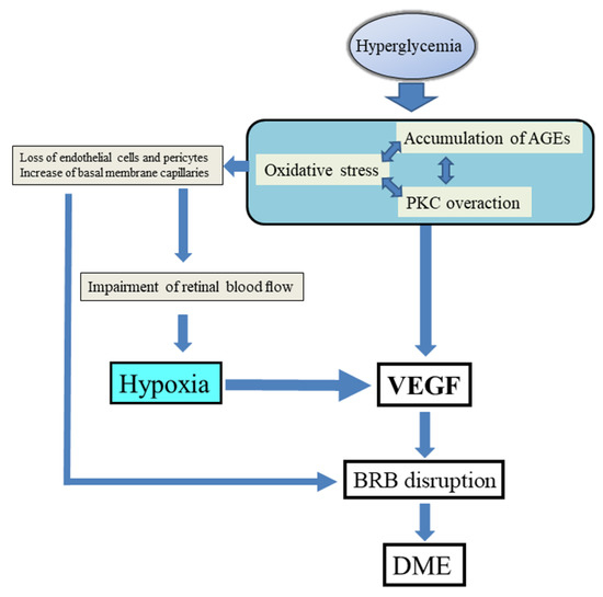 Involvement of Cytokines in the Pathogenesis of Diabetic Macular Edema