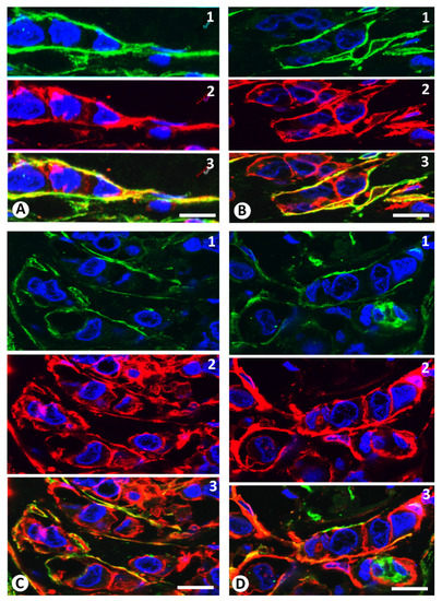 IJMS | Special Issue : Molecular Morphology and Function of Stromal Cells