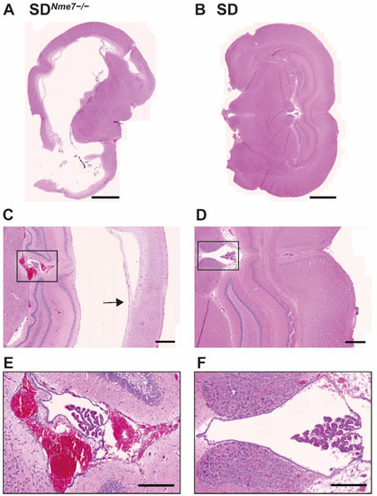 IJMS | Special Issue : Primary Ciliary Dyskinesia: Genetics, Molecular ...