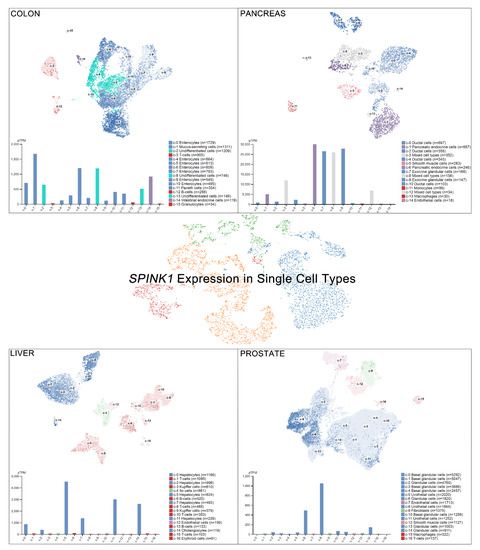 Functional Roles of SPINK1 in Cancers