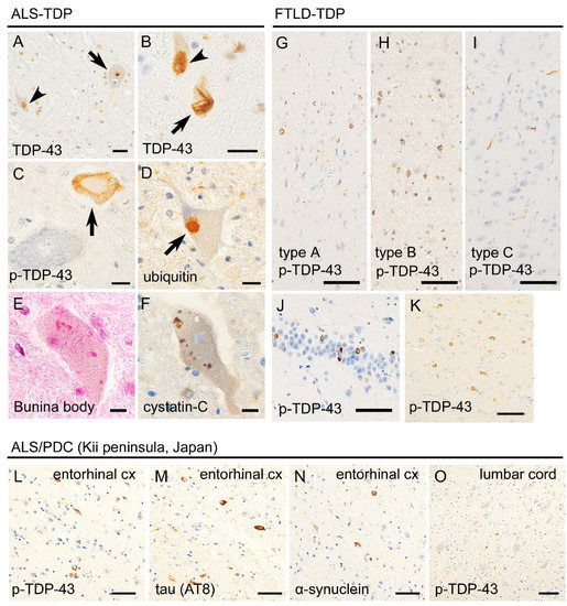 Pathway from TDP-43-Related Pathology to Neuronal Dysfunction in ...