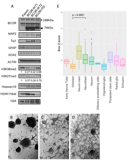 BCOR Internal Tandem Duplication Expression in Neural Stem Cells ...