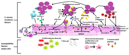 Molecular Mechanisms of Atopic Dermatitis Pathogenesis
