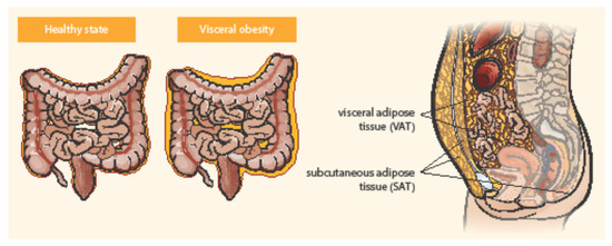 Role of Adipose Tissue in Inflammatory Bowel Disease