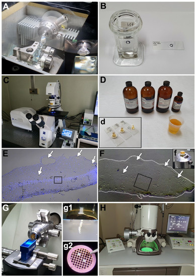 Correlative Light and Electron Microscopy Using Frozen Section Obtained Using Cryo-Ultramicrotomy