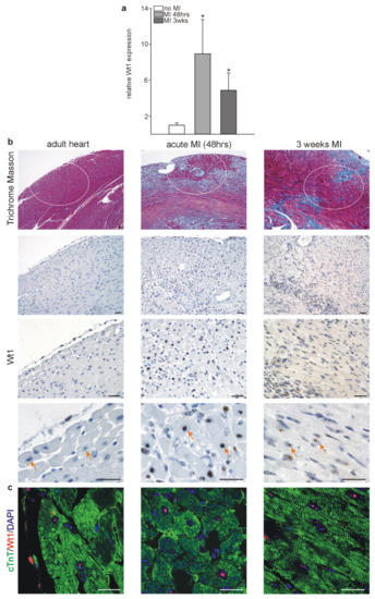 Implications of the Wilms’ Tumor Suppressor Wt1 in Cardiomyocyte ...